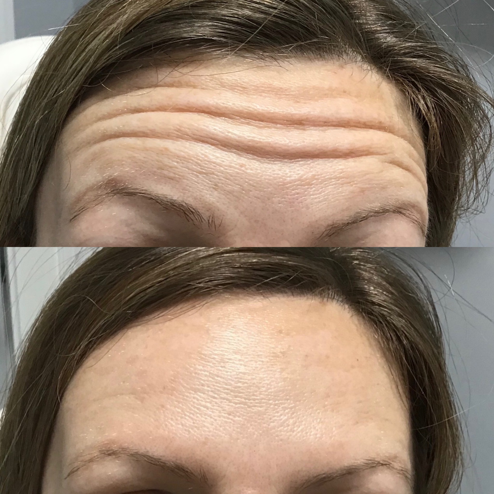 $4/unit Tox - Face Fabulous